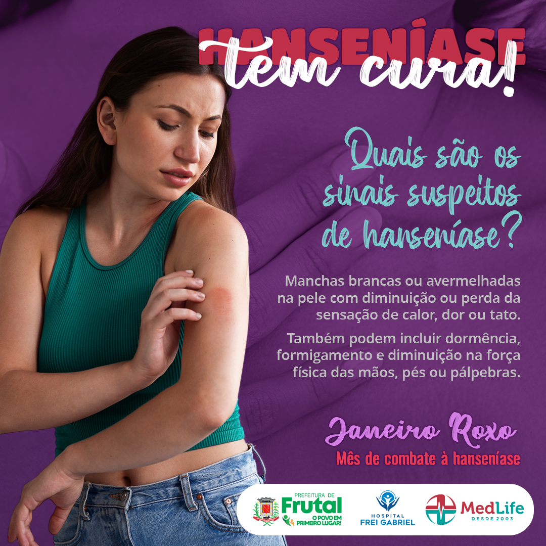Janeiro Roxo — Quais são os sinais suspeitos de hanseníase? - Med Life